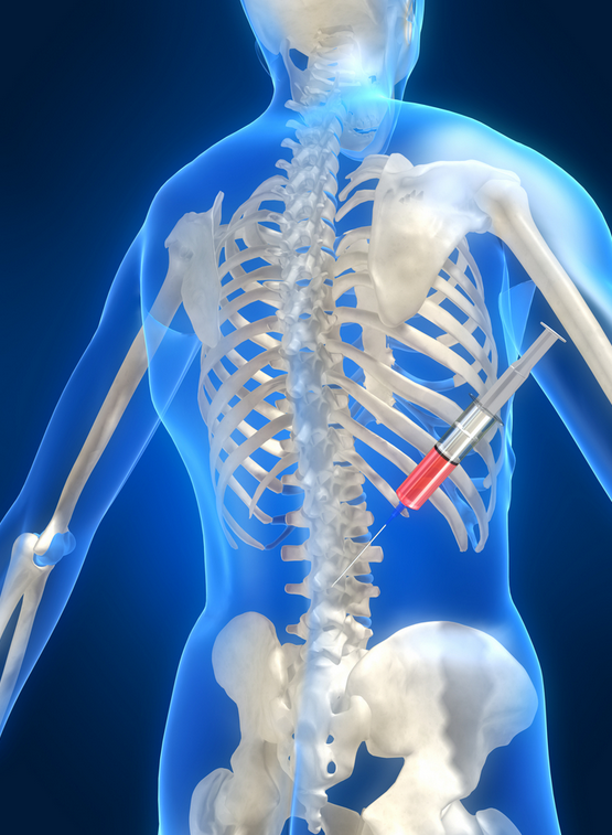 Spinal Stenosis | Tomoya Sakai, MD |Board Certified Pain Physician ...